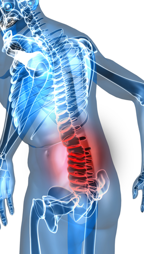 Back Pain 101 — Spine Design